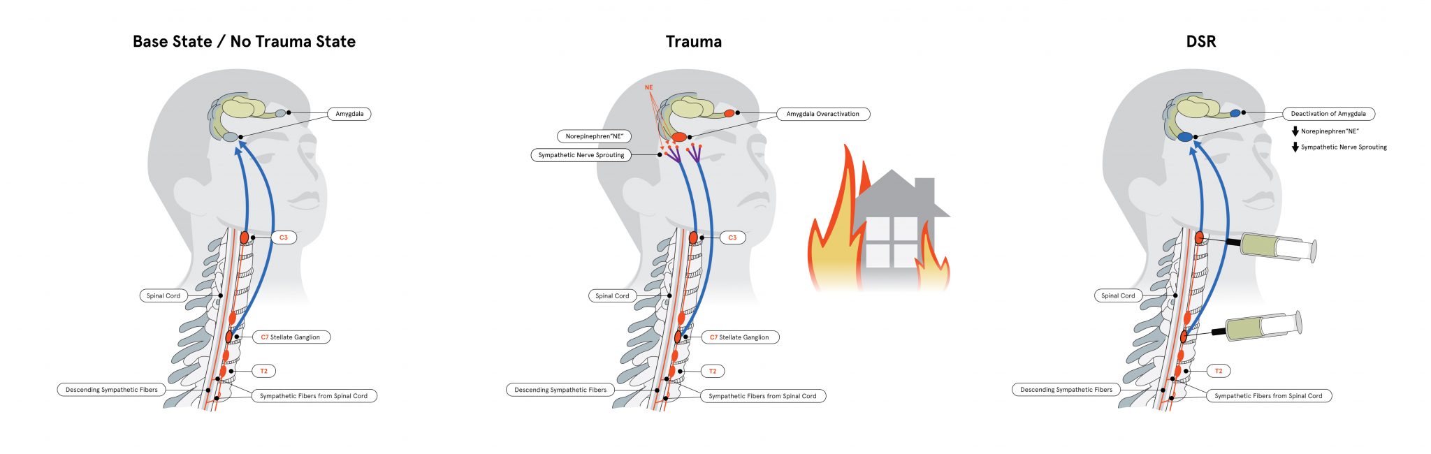 Fight-or-Flight System Changes from Trauma - Police Chief Magazine